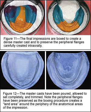 Building the Edentulous Impression - A Layering Technique Using ...